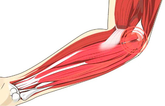 Elbow Treatment in Muskegon & Grand Haven, MI | Orthopaedic Associates ...